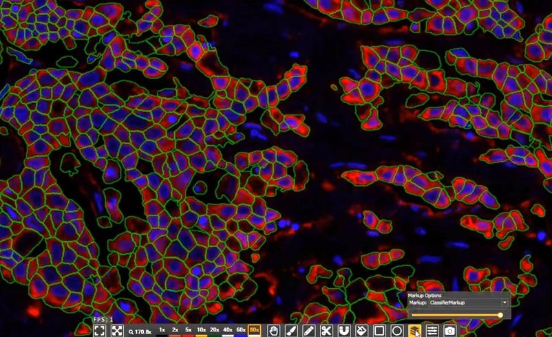 Indica Labs announces AI-powered HALO® software release for digital pathology research in life ...